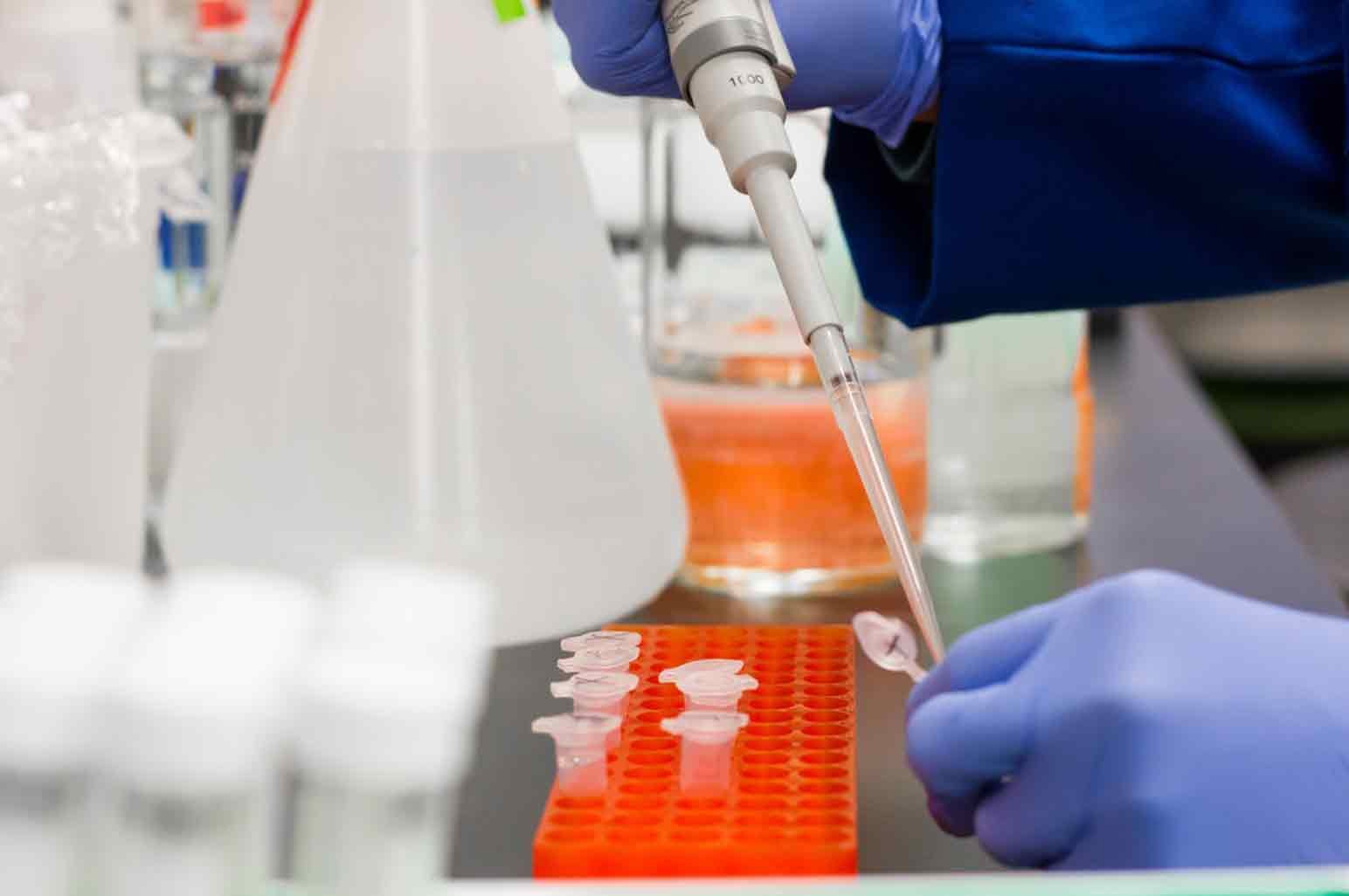 Here Is What You Need To Know About PRP Therapy - AnnMarie John
