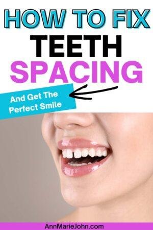 How to Fix Teeth Spacing and Get the Perfect Smile - AnnMarie John