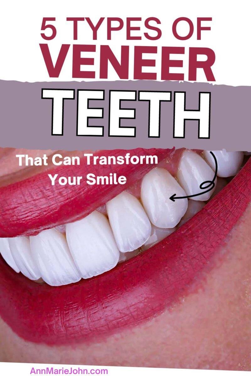 5 Types of Veneer Teeth That Can Transform Your Smile - AnnMarie John