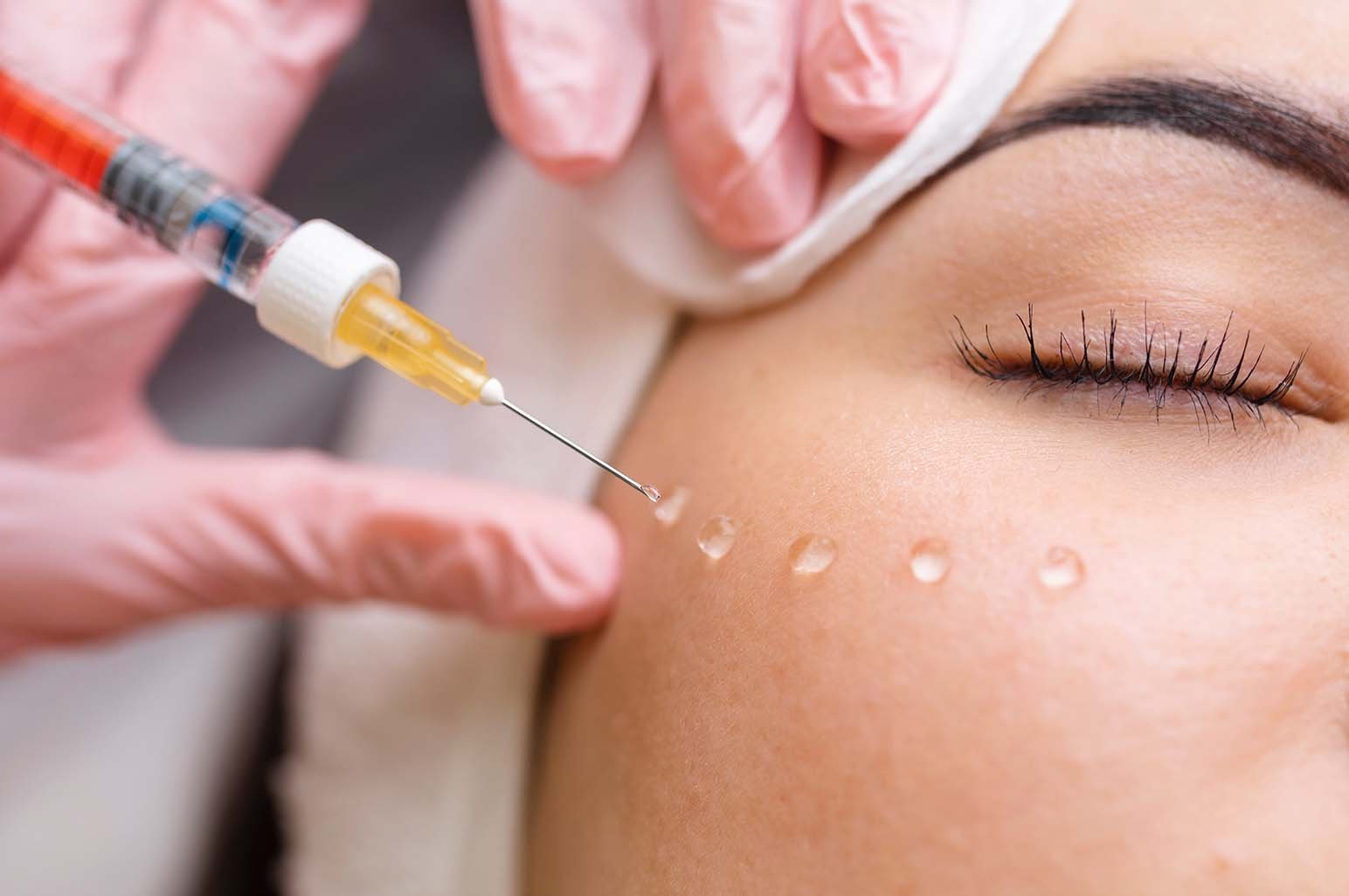 The Journey To Youthful Skin: Understanding Facial Fillers - AnnMarie John