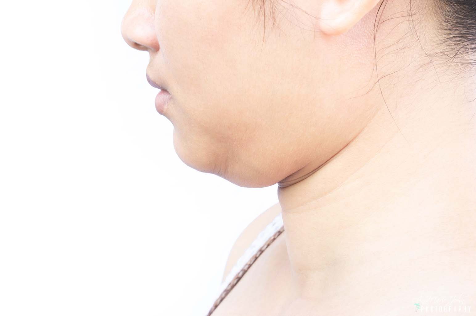 Double Chin Blues? Try These Proven Methods for Banishing It for Good ...