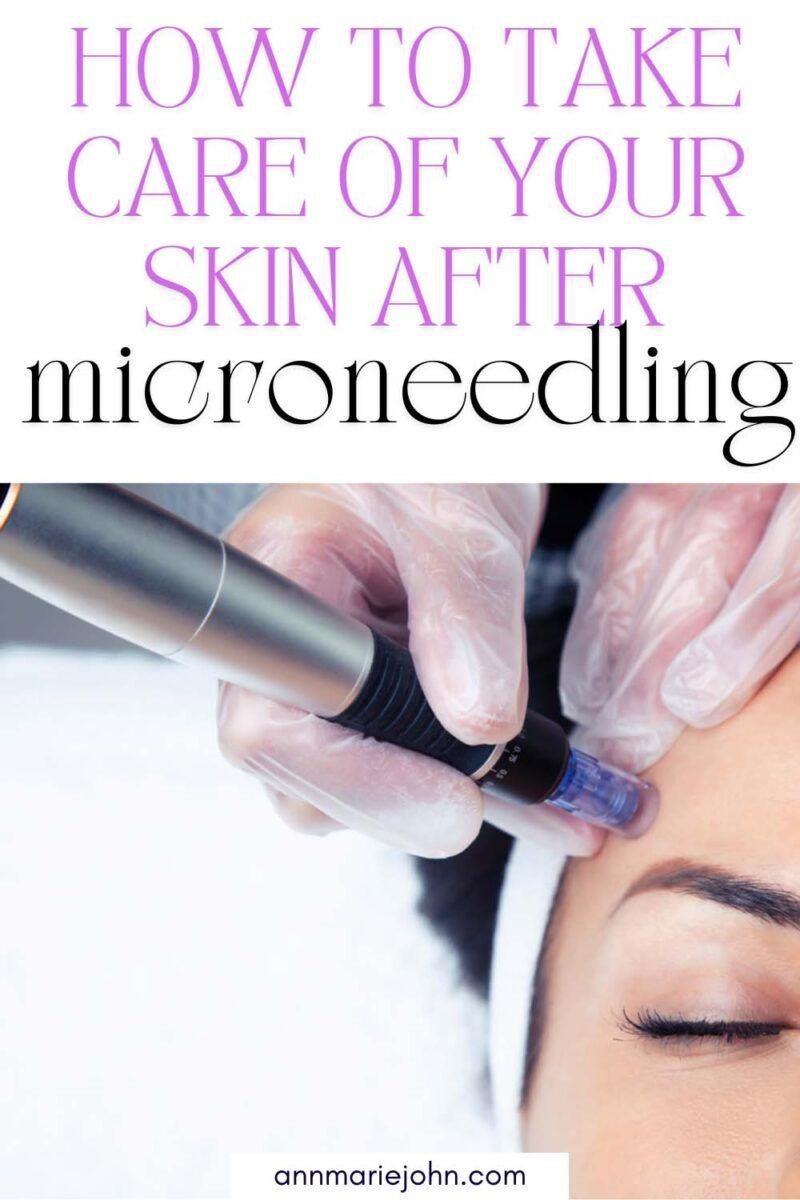 How to Take Care of Your Skin After Microneedling: The Ultimate Guide - AnnMarie John